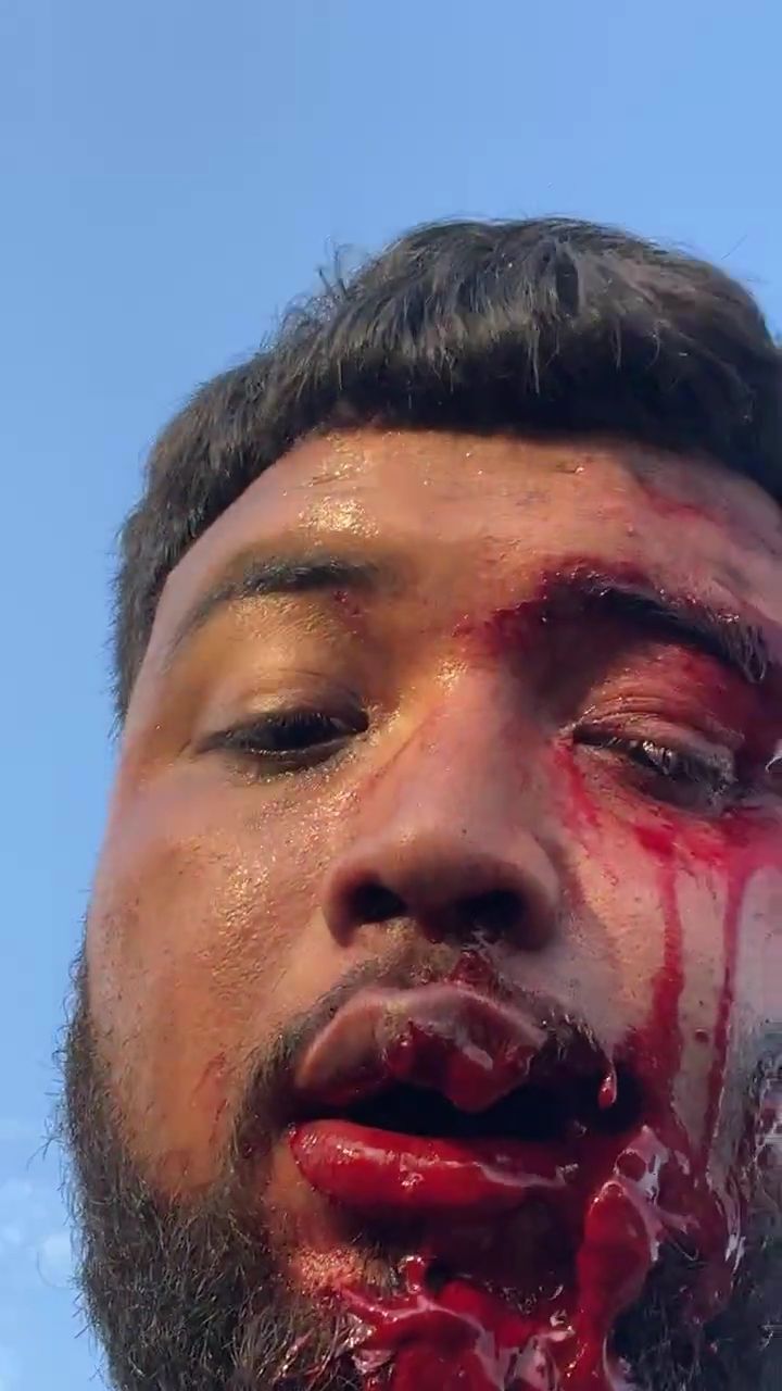 Guy started broadcasting live after being shot in face • GoreCenter