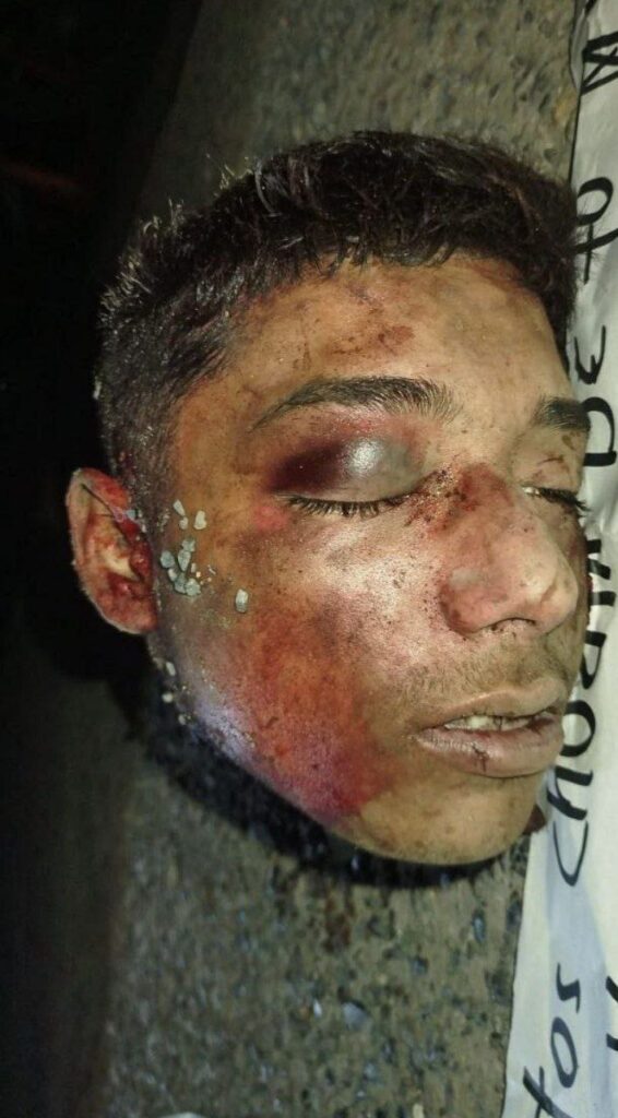 Cartel beheaded captive and threw his head onto street • GoreCenter