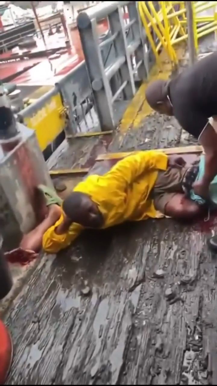 Snapped marine rope tore off fisherman’s leg • GoreCenter