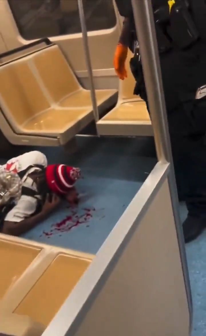 Injured by firearm on subway train • GoreCenter
