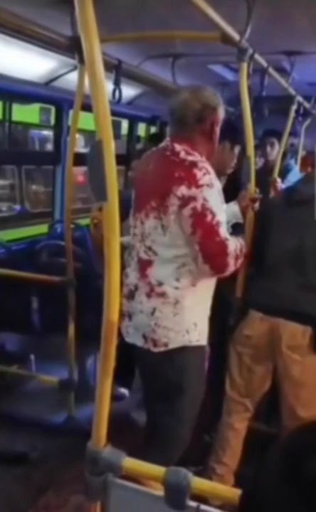 Passenger shot in abdomen during armed bus robbery • GoreCenter